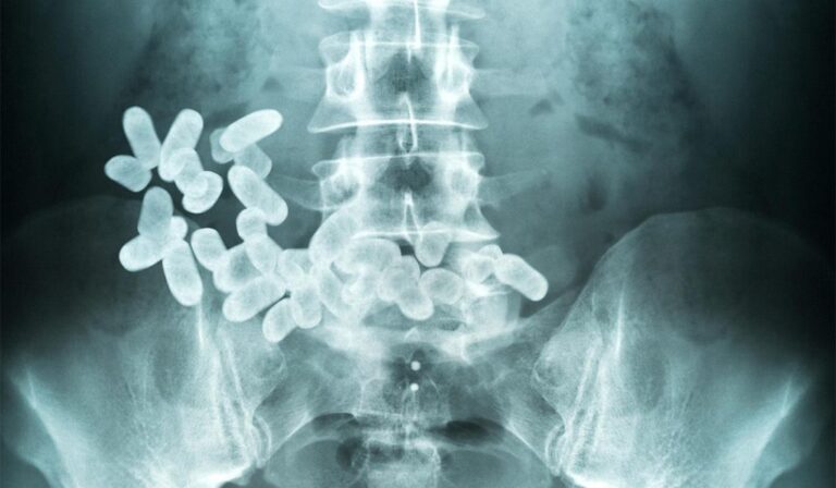 Descubre cómo se ve la droga en rayos y adquiere información valiosa ...