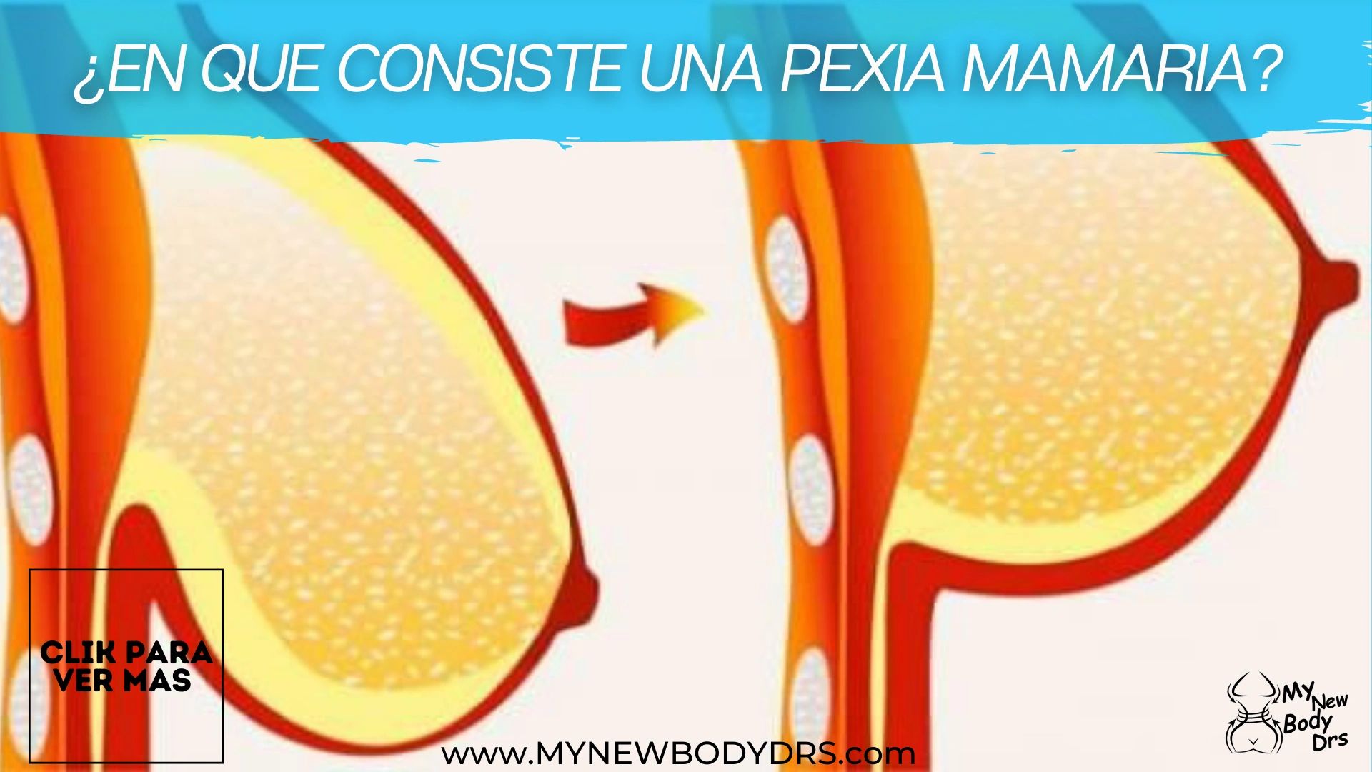 ¿Quieres reafirmar tus senos caídos de forma rápida? Descubre cómo lograrlo en solo 5 días